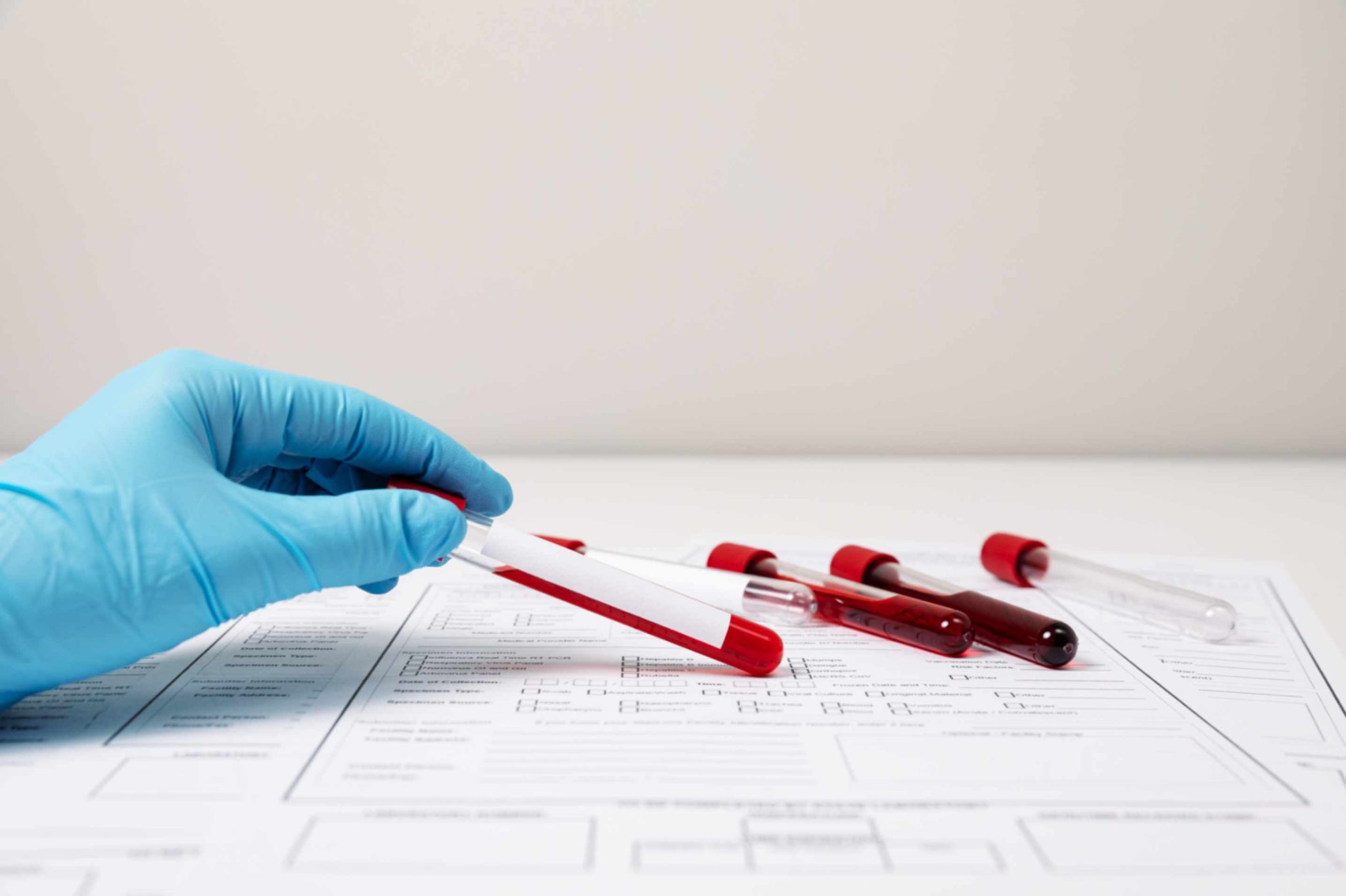 How Much Does a Private Blood Test Cost in the UK? - Aroga Pharmacy